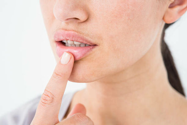 Why Lipstick Make Lips Dark – Causes, Prevention, and Expert Solutions ...